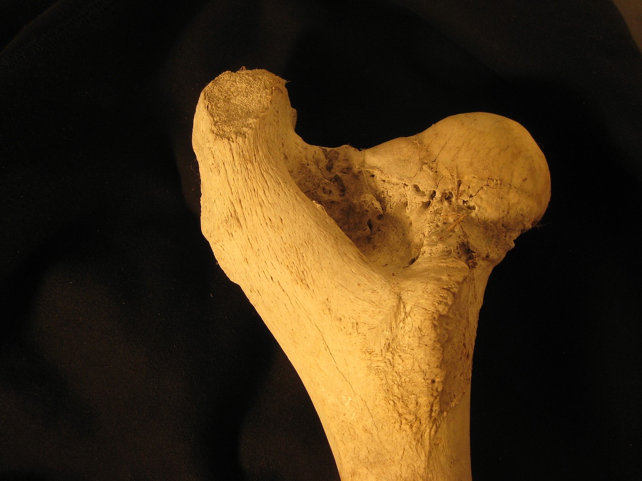 Essentials of Bone Health: Tips & Insights - Rolling Strong